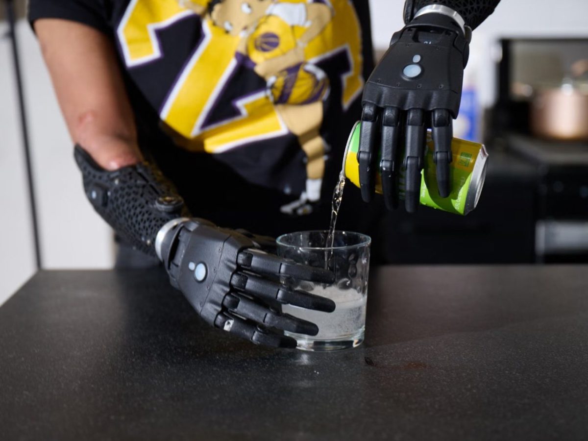The Groundbreaking Hero Pro Bionic Arm Redefines Prosthetic Technology ...