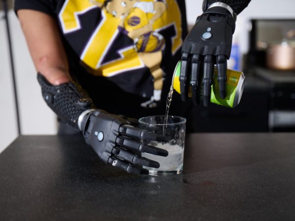 The Groundbreaking Hero Pro Bionic Arm Redefines Prosthetic Technology ...