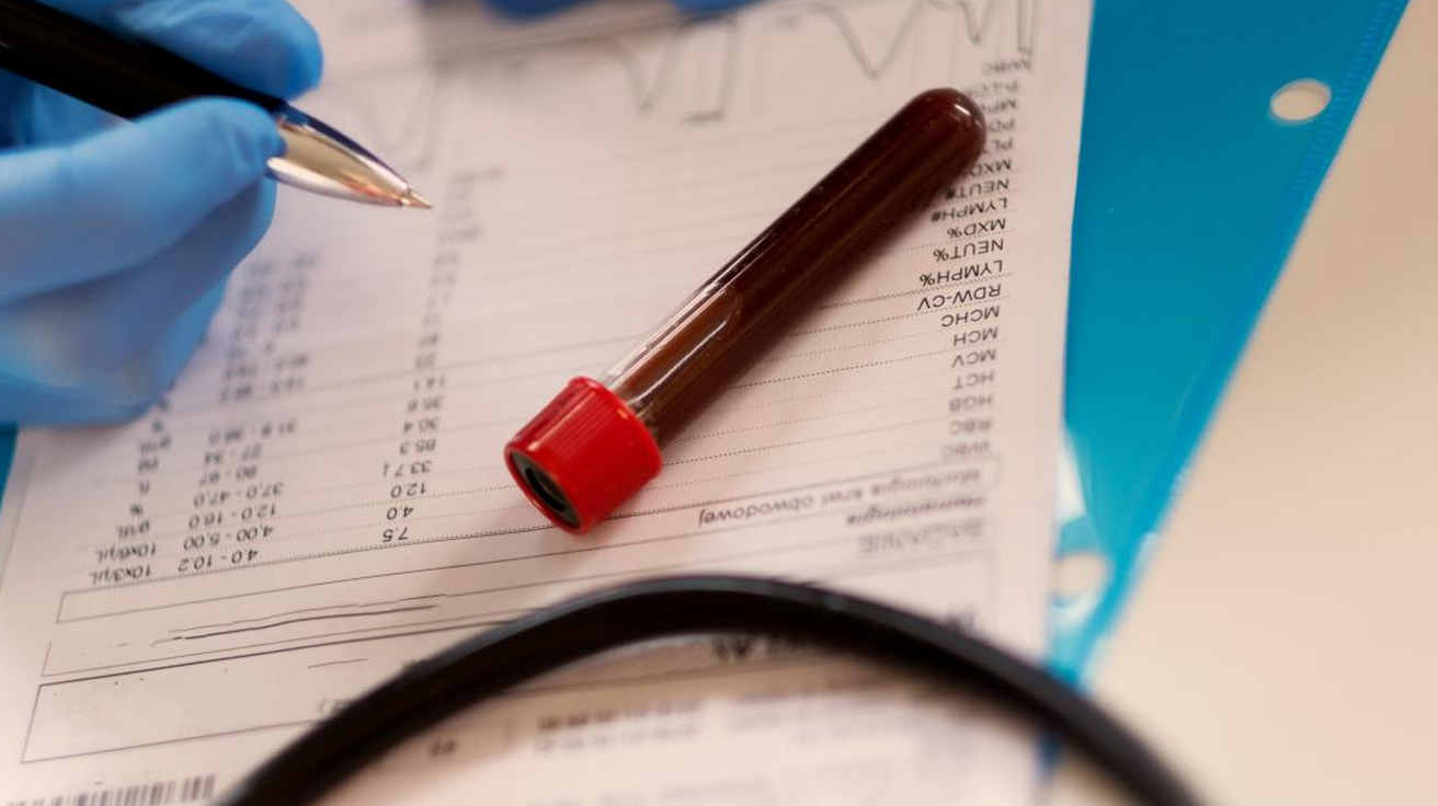 Your Rain Jacket Might Be Poisoning You - Gadget Review