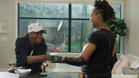 The Groundbreaking Hero Pro Bionic Arm Redefines Prosthetic Technology ...