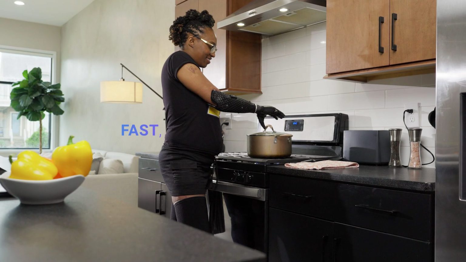 The Groundbreaking Hero Pro Bionic Arm Redefines Prosthetic Technology ...