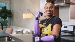 The Groundbreaking Hero Pro Bionic Arm Redefines Prosthetic Technology ...