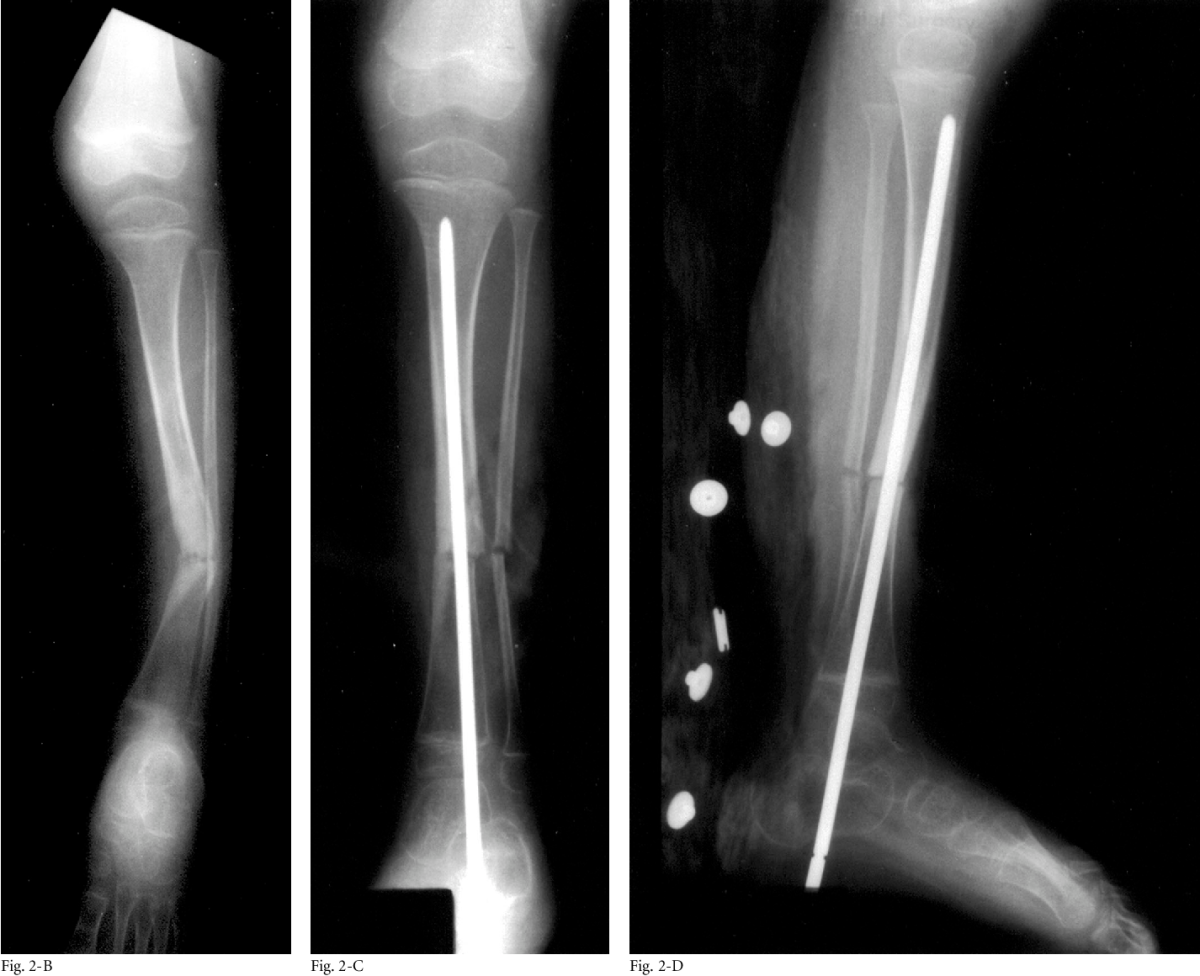 The Hidden History of 18 Inventions from Nazi Germany - Gadget Review